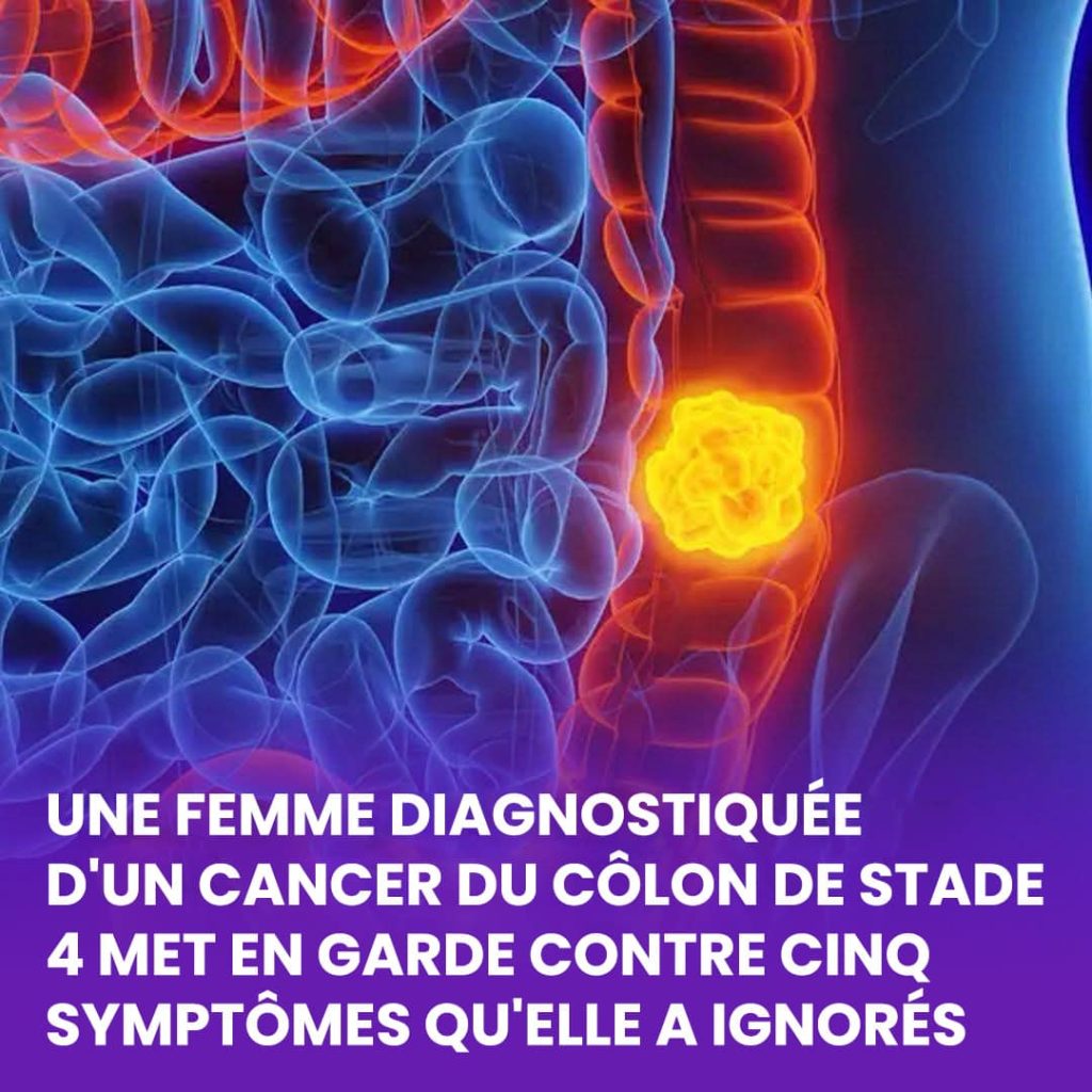 Les Signes Silencieux du Cancer du Côlon à Connaître Absolument - Infos ...